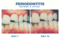 Hydro Floss® Oral Irrigator